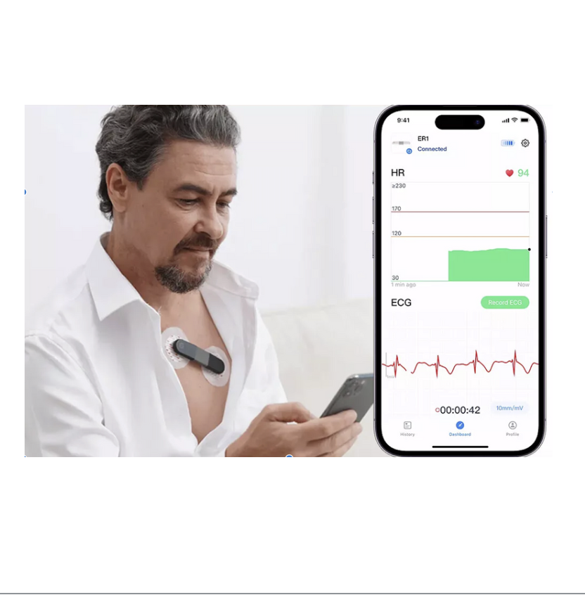 Holter Dynamic ECG 24h - ekg holter Bexamed.cz